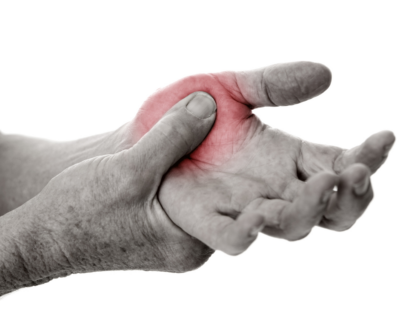 What is Scaphoid Fracture Fixation - Mobility Bone & Joint Institute